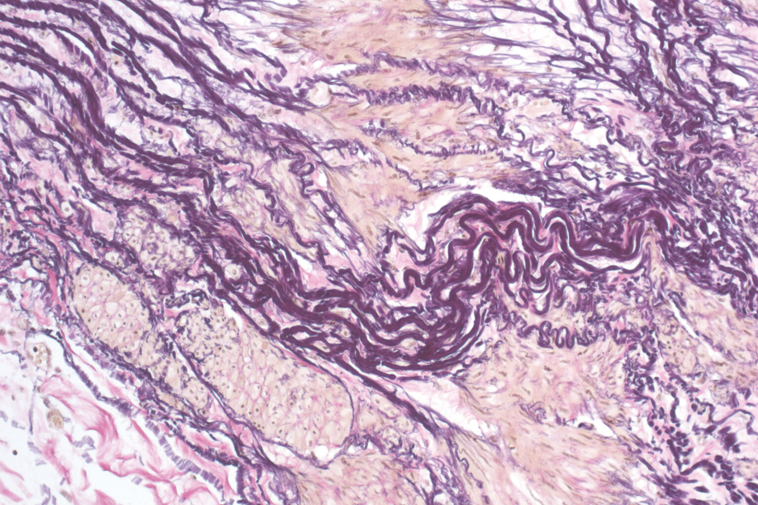 Elastica-Van Gieson kit - Biognost