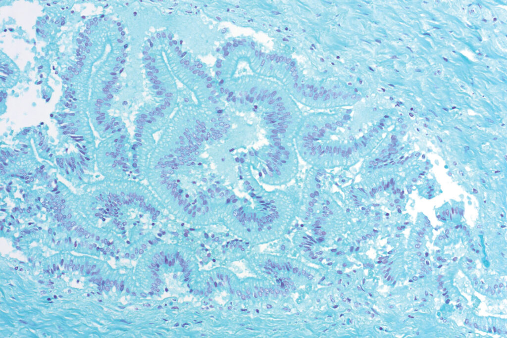 Feulgen kit - Biognost