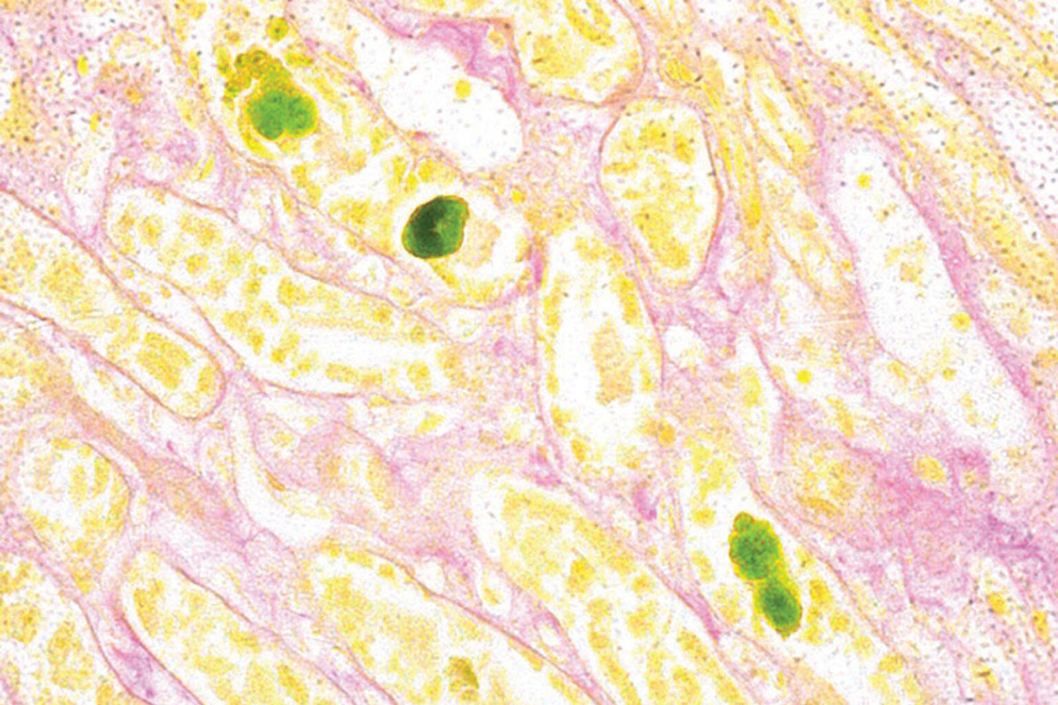 Fouchet-Van Gieson kit - Biognost