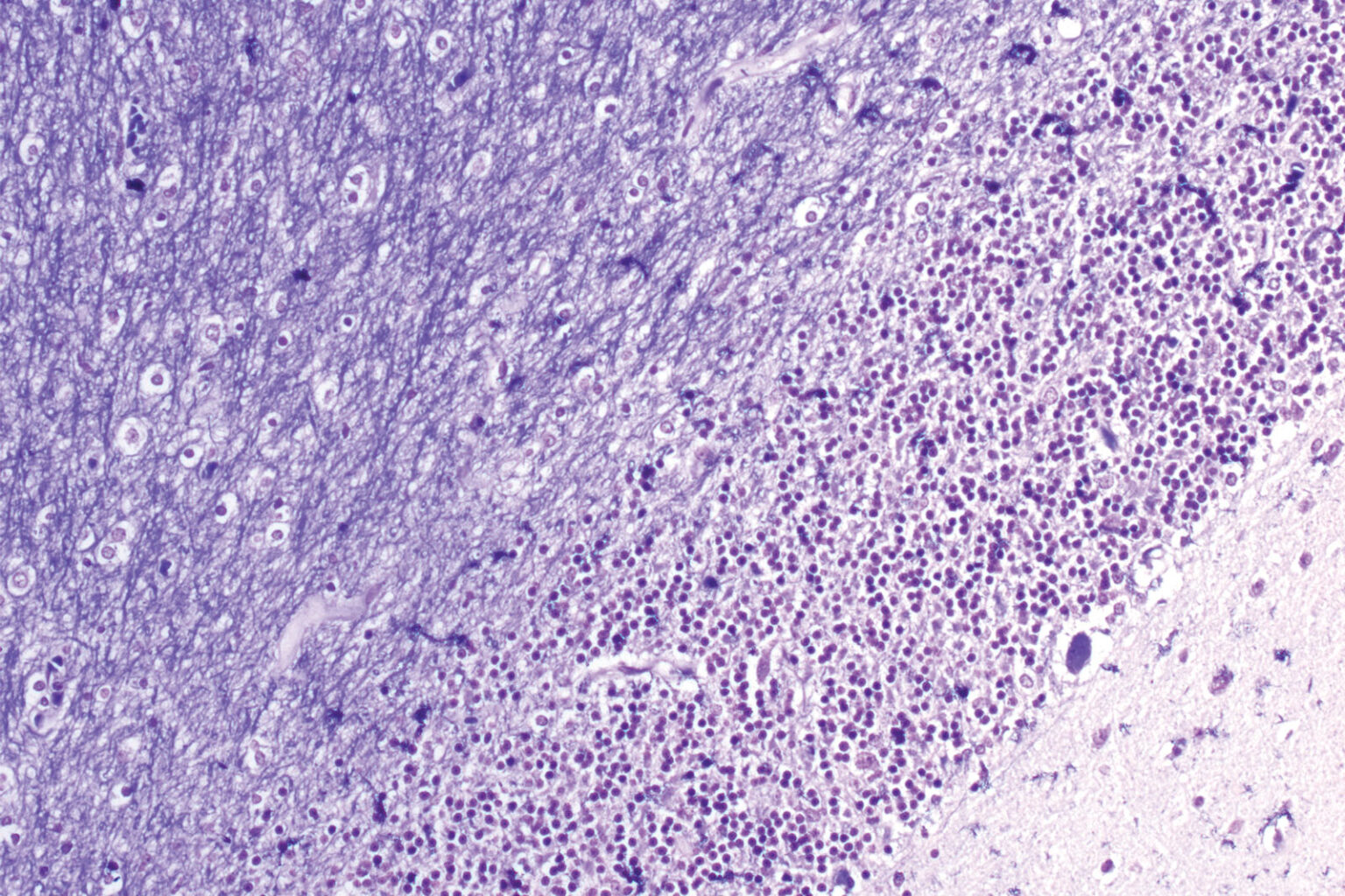 Luxol Fast Blue kit - Biognost