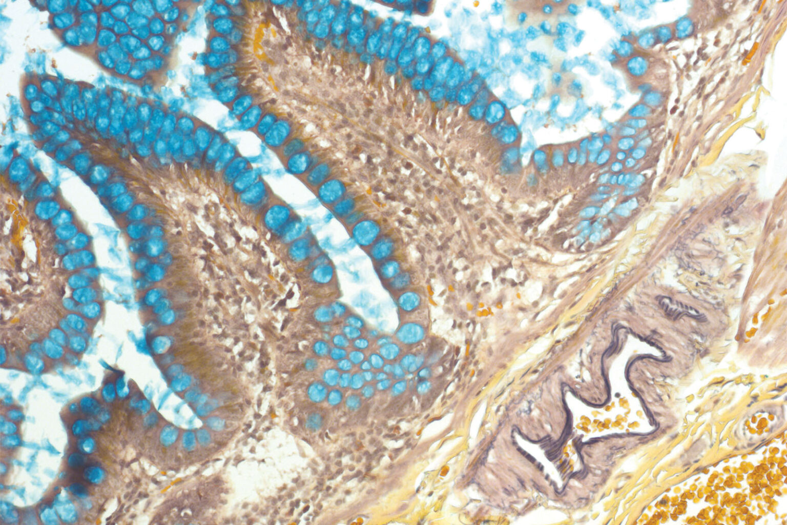 Movat kit - Biognost