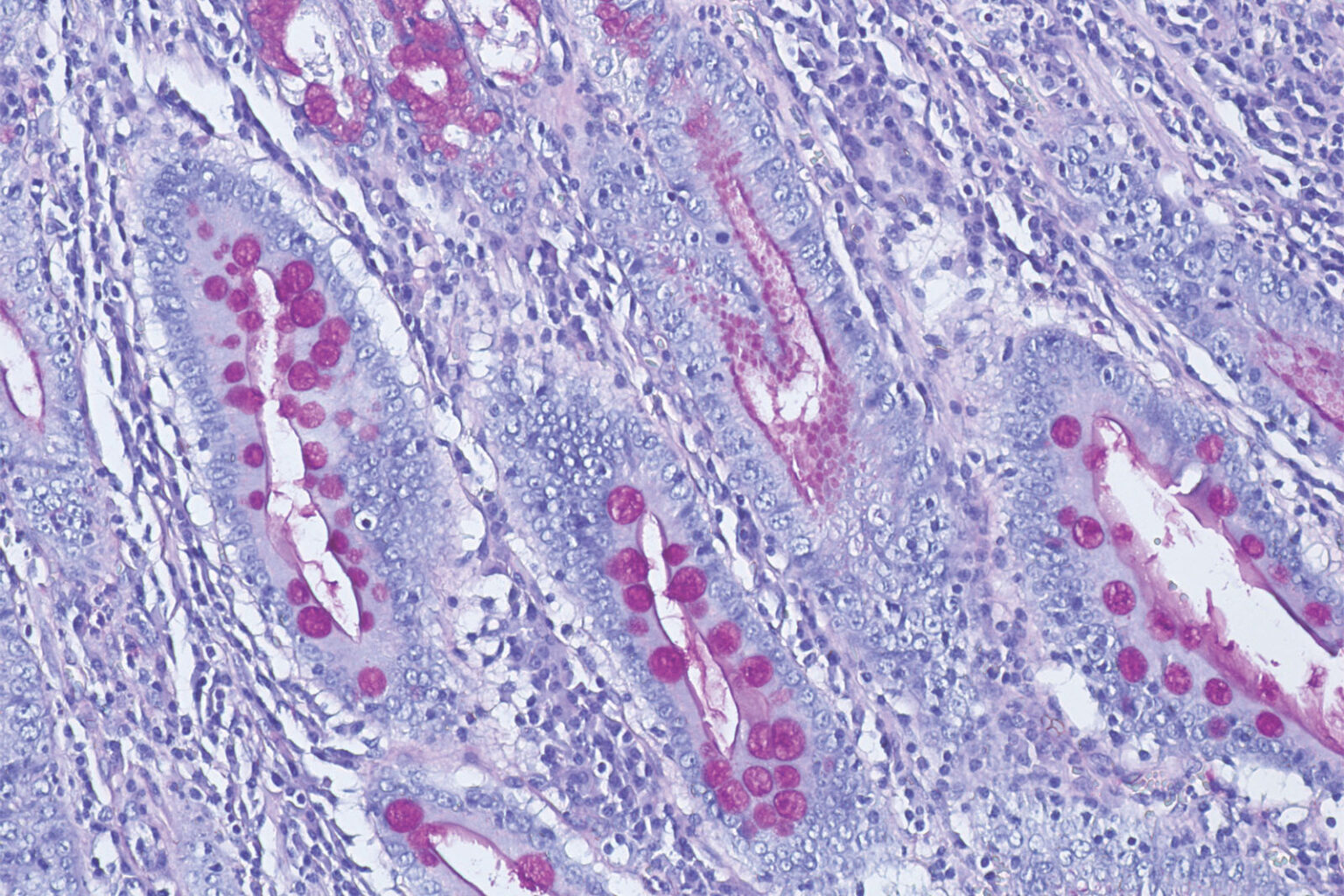 P.A.S. kit - Biognost