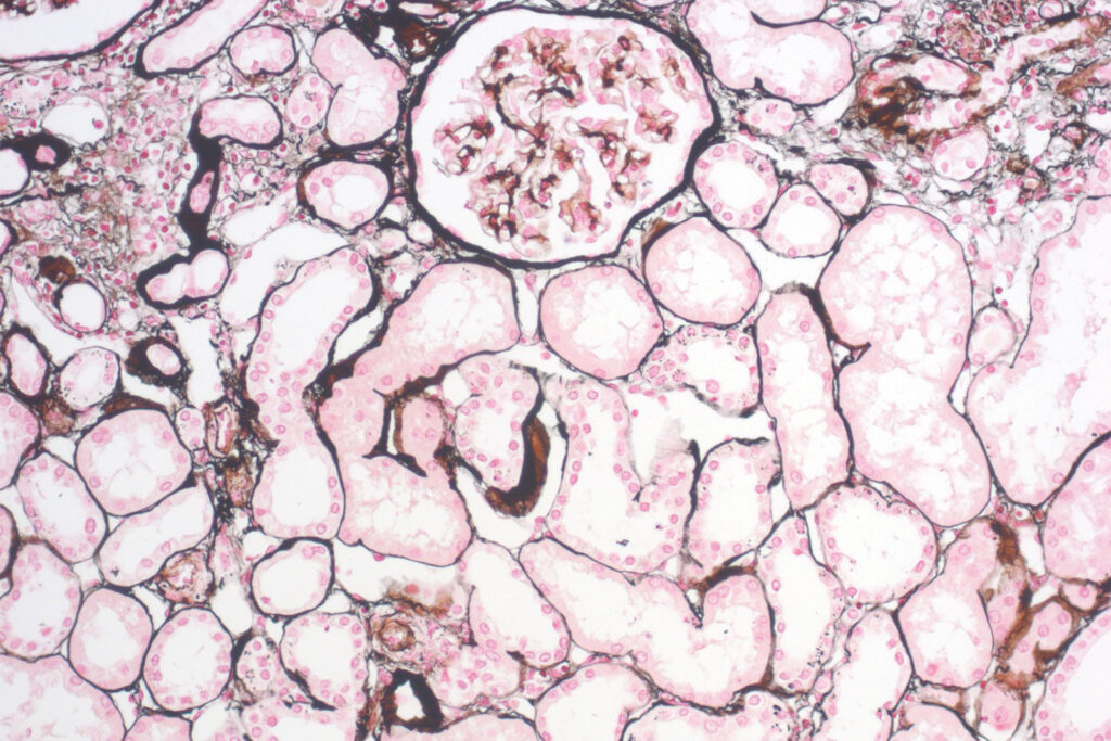 P.A.S.M. / Jones kit, stabilized - Biognost