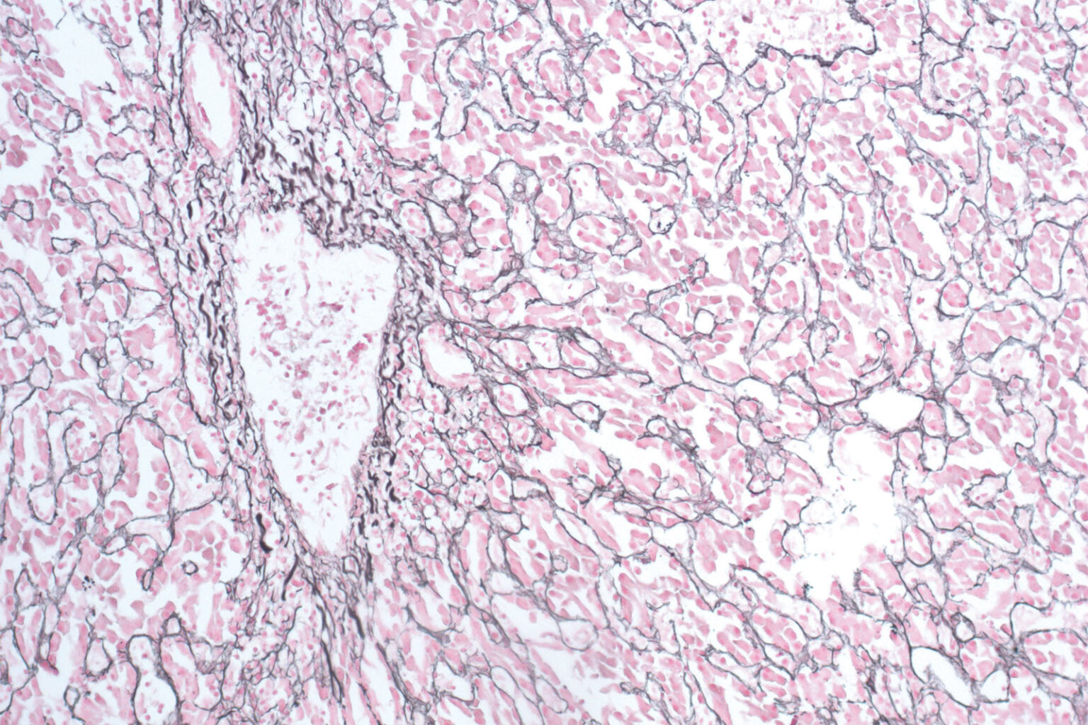 Reticulin Contrast kit - Biognost