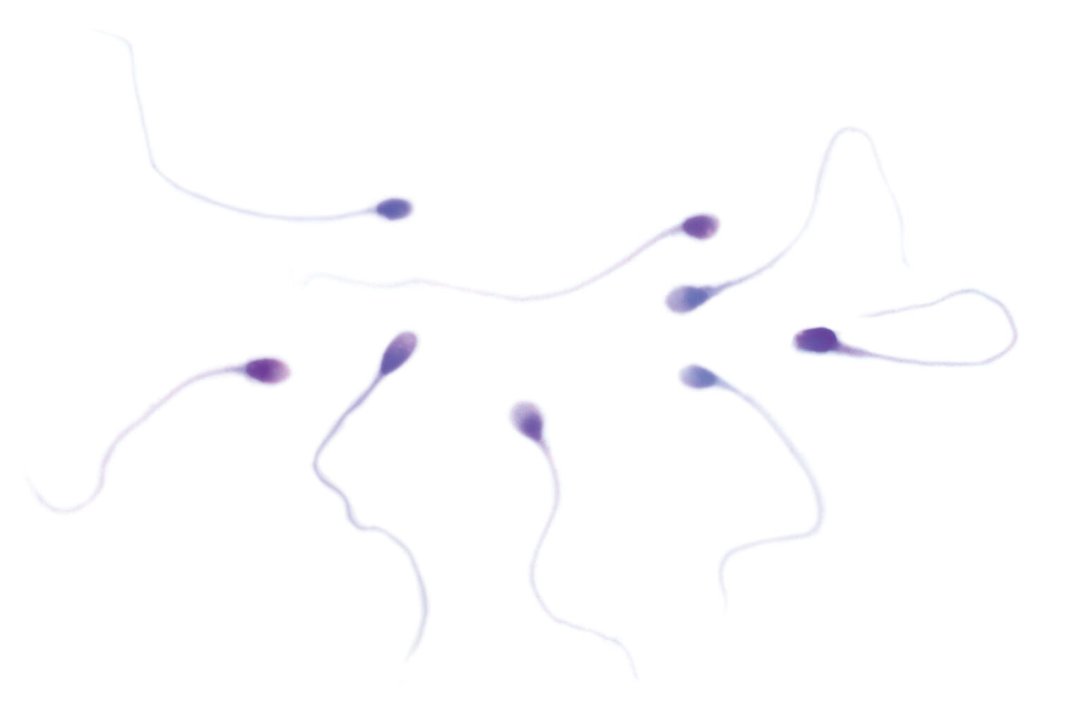 Sperm-Diff RTU kit - Biognost