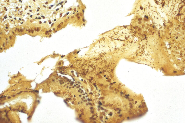 Warthin Starry kit - Biognost