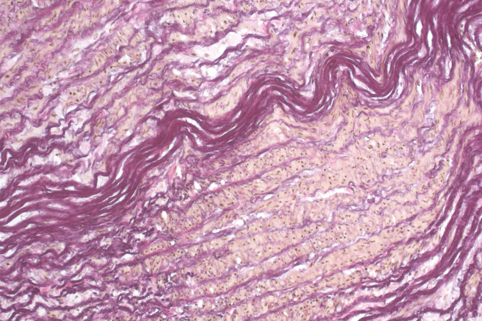 Weigert-Van Gieson kit - Biognost