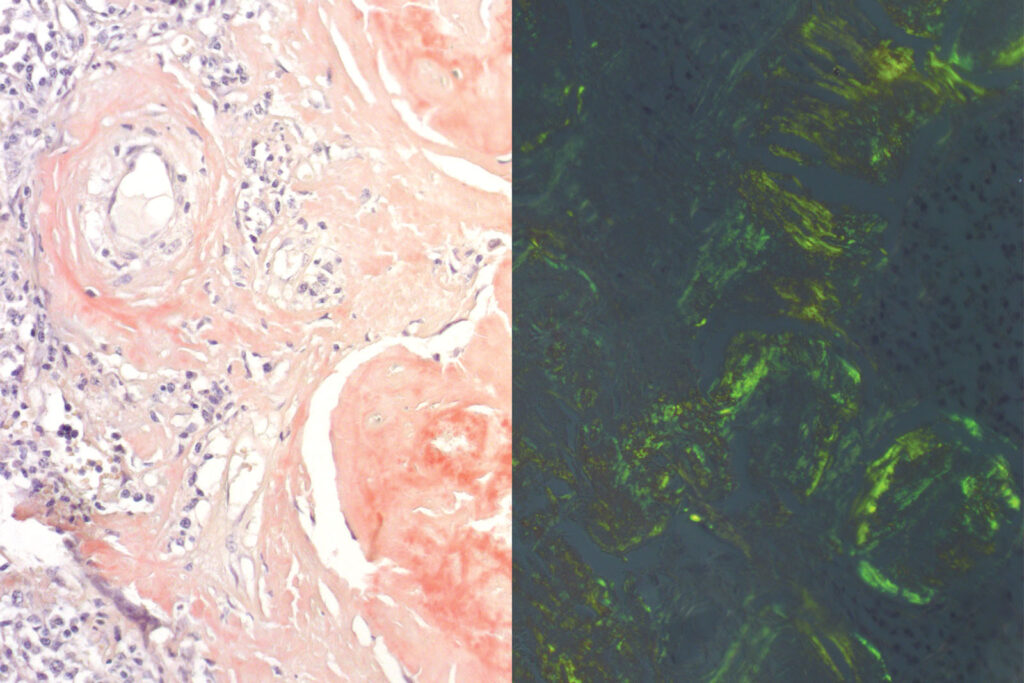 Congo Red Puchtler kit - Biognost