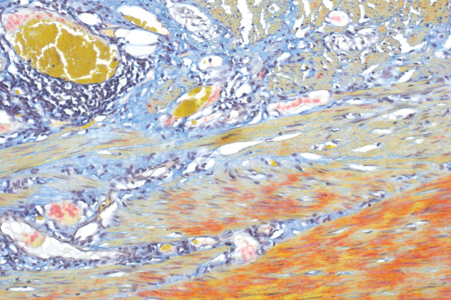 Martius Scarlet Blue (MSB) kit - Biognost