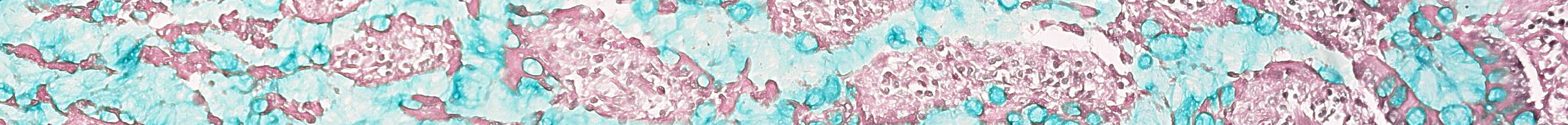 Research and Development - Biognost